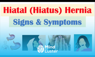 Learn Hiatal Hiatus Hernia Signs Symptoms Why They Occur - Mind Luster