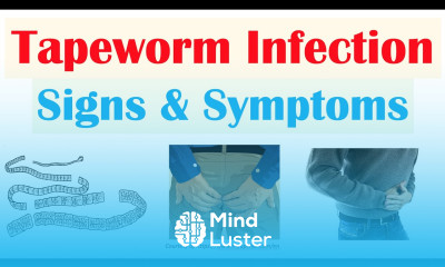 Learn Tapeworm Infection Signs Symptoms Nutrient Deficiencies ...