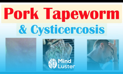 Learn Pork Tapeworm Taeniasis How It Infects Symptoms Cysticercosis ...