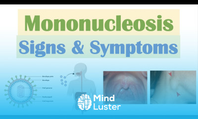 Learn Infectious Mononucleosis Mono Signs Symptoms - Mind Luster