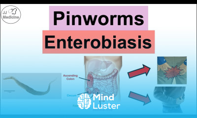Learn Pinworms Enterobiasis Infection Transmission Symptoms Diagnosis ...