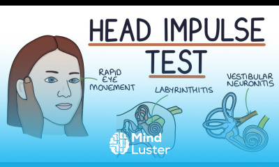 Learn The Head Impulse Test - Mind Luster