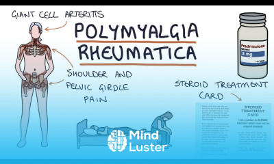 Learn Polymyalgia Rheumatica Visual Explanation for Students - Mind Luster