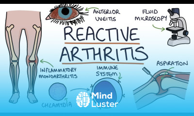 Learn Understanding Reactive Arthritis - Mind Luster