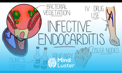 Learn Infective Endocarditis With Duke Criteria Pathophysiology - Mind ...