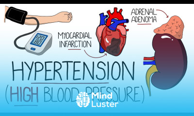 Learn Hypertension Explained High Blood Pressure Includes Hypertensive ...