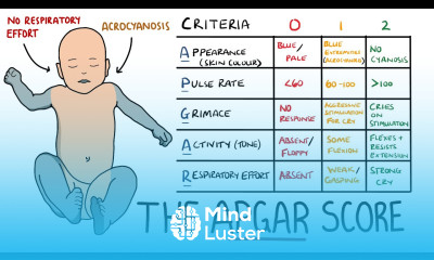 Learn APGAR Score Made Easy Newborn Assessment APGAR Mnemonic - Mind Luster