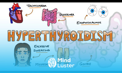Learn Hyperthyroidism Signs and Symptoms Mnemonic SWEATING - Mind Luster