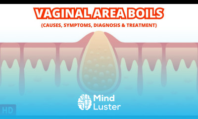 Learn Dealing with Vaginal Area Boils Tips and Advice for Fast Relief ...