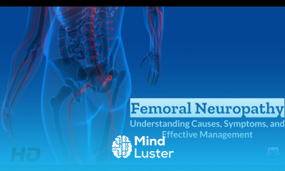 Learn Femoral Neuropathy Unveiled What You Need to Know - Mind Luster