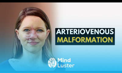 Learn Arteriovenous Malformation Causes Signs and Symptoms Diagnosis and Treatment - Mind Luster