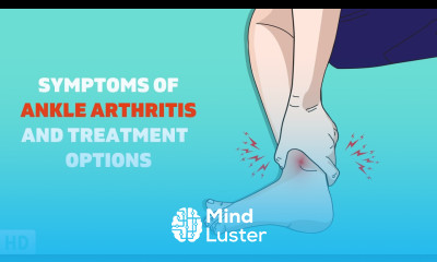 Learn Don t Ignore Your Ankle Pain Understanding Ankle Arthritis - Mind ...