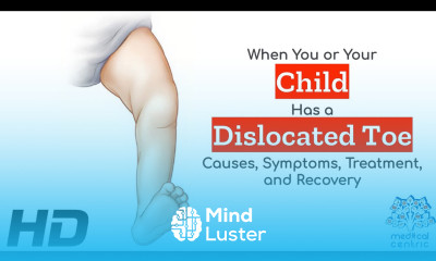 Learn Toe Injuries How to Handle a Dislocated Toe with Care - Mind Luster
