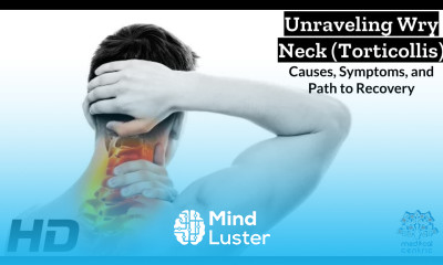 Learn Wry Neck Torticollis The Silent Struggle and How to Overcome It ...