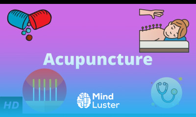 Learn Acupuncture What You Need to Know - Mind Luster