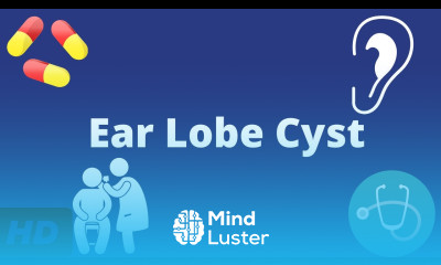 Learn Ear Lobe Cyst Everything You Need to Know - Mind Luster