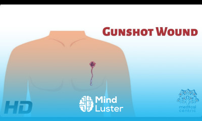 Learn Gunshot Wound Everything You Need To Know - Mind Luster