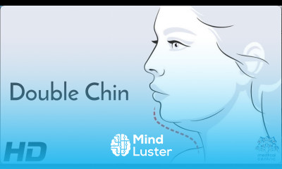 Learn Double Chin No More Tips and Tricks to Get a Defined Jawline ...