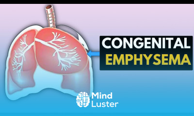 Learn Beyond the Surface Exploring Congenital Emphysema and Its Hidden ...