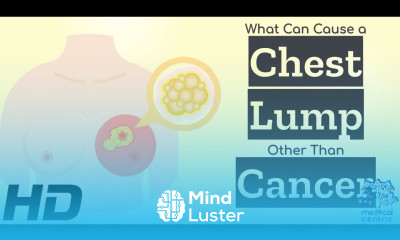 Learn Chest Lumps Explained When It s Not a Tumor - Mind Luster