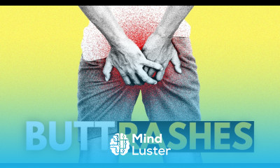 Learn Butt Rashes What You Need to Know - Mind Luster