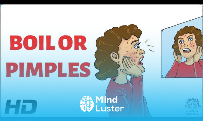 Learn Boils vs Pimples What s the Difference and How to Treat Them ...