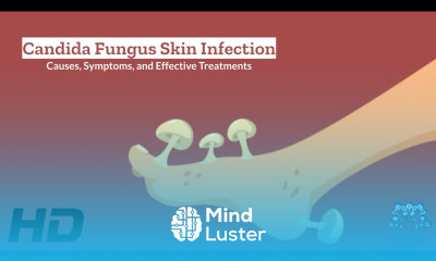Learn Candida Fungus Skin Infection Explained What You Need to Know ...