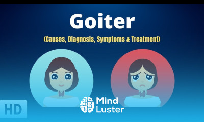 Learn Goiter Causes Diagnosis Symptoms and Treatment - Mind Luster