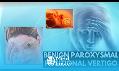 Learn Benign Paroxysmal Positional Vertigo What You Need To Know - Mind ...