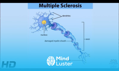 Learn MULTIPLE SCLEROSIS Everything You Need To Know - Mind Luster