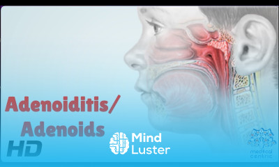 Learn Adenoiditis Adenoids Everything You Need To Know - Mind Luster