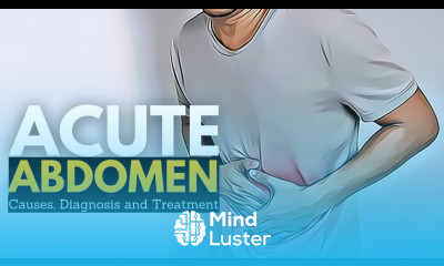 Learn ACUTE ABDOMEN Everything You Need To Know - Mind Luster