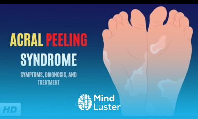 Learn Acral Peeling Syndrome Symptoms Diagnosis and Treatment - Mind Luster