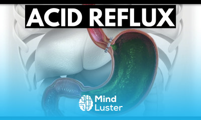Learn ACID REFLUX – EVERYTHING YOU NEED TO KNOW - Mind Luster