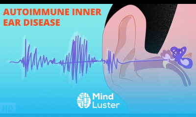 Learn Battling Autoimmune Inner Ear Disease Treatment Options and ...