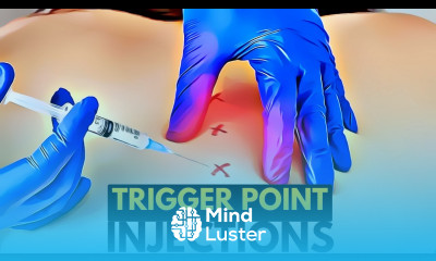 Learn The Anatomy of Pain Relief A Look at Trigger Point Injections ...