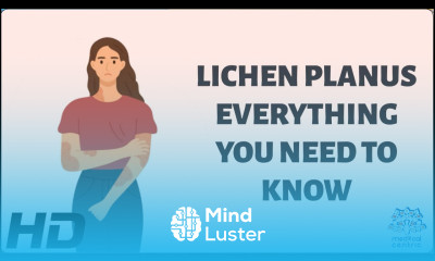 Learn Unlocking the Mystery of Lichen Planus Everything You Need to ...