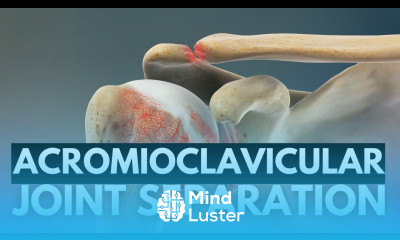 Learn Acromioclavicular Joint Separation Navigating Symptoms and ...