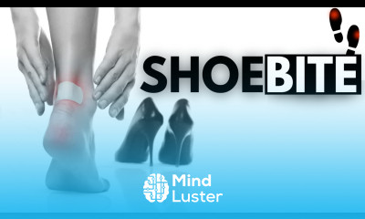 Learn Shoe Bites No More Effective Prevention and Solutions - Mind Luster