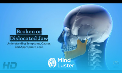 Learn Broken or Dislocated Jaw Mending the Misery - Mind Luster