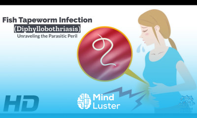 Learn Diphyllobothriasis Exposed Decoding the Mystery of Fish Tapeworm ...