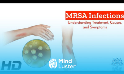 Learn MRSA Unmasked A Comprehensive Guide to Causes Symptoms and ...