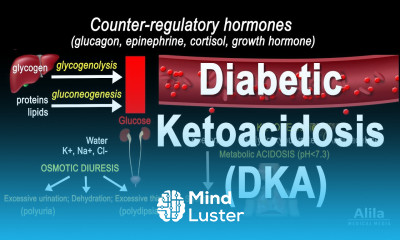 Learn Diabetic Ketoacidosis DKA Pathophysiology Animation - Mind Luster