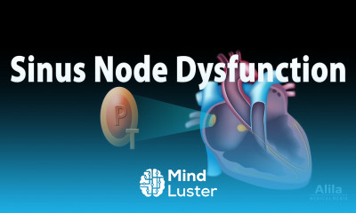 Learn Sinus Node Dysfunction Animation - Mind Luster