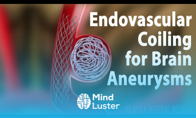 Learn Endovascular Coiling for Brain Aneurysm Animation - Mind Luster