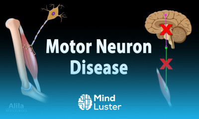 Learn Motor Neuron Disease Animation - Mind Luster