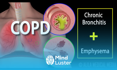 Learn COPD Chronic Obstructive Pulmonary Disease Animation - Mind Luster