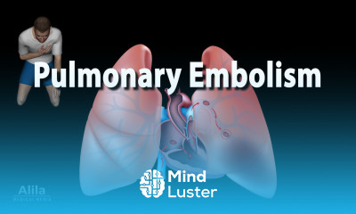 Learn Pulmonary Embolism Animation - Mind Luster