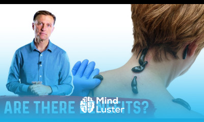 Learn What is Leech Therapy - Mind Luster