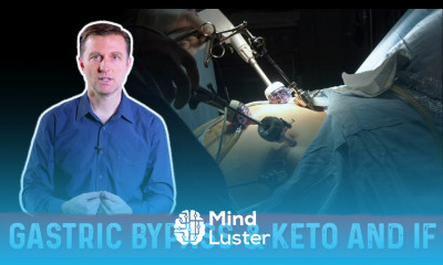 Learn Gastric Bypass Keto and Intermittent Fasting – Dr Berg - Mind Luster